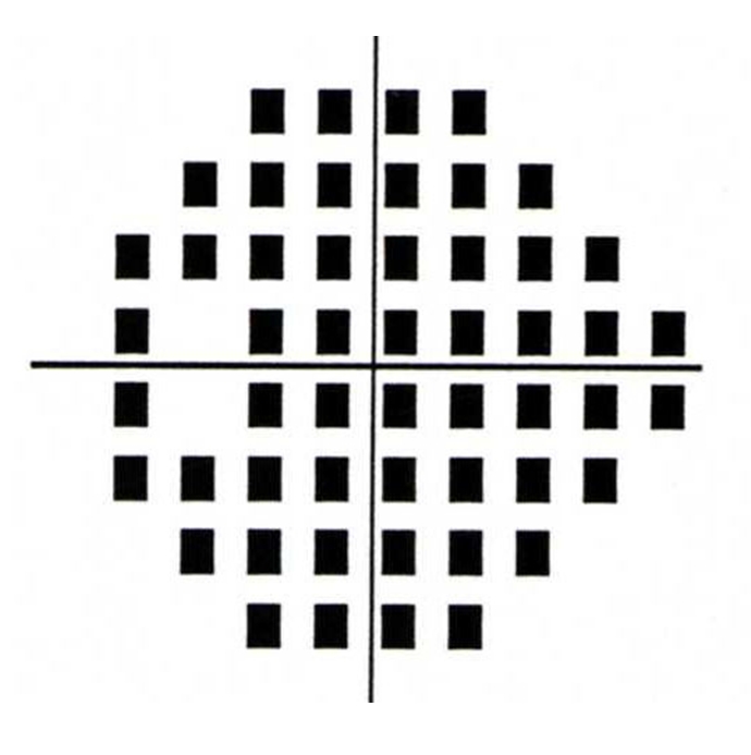 Ch. 1 Glaucoma: Optic Nerve Disease. A Patient's Guide to Glaucoma