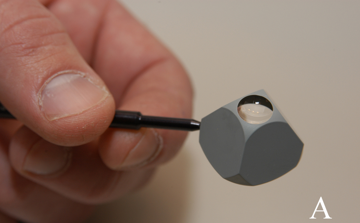 Ch 3 The Glaucoma Eye. A Patient's Guide to Glaucoma