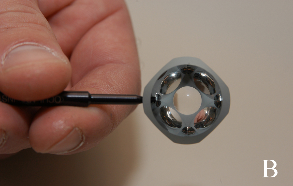 Ch 3 The Glaucoma Eye. A Patient's Guide to Glaucoma