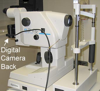 Ch 6 The glaucoma eye examination and diagnosis. A Patient's Guide to ...