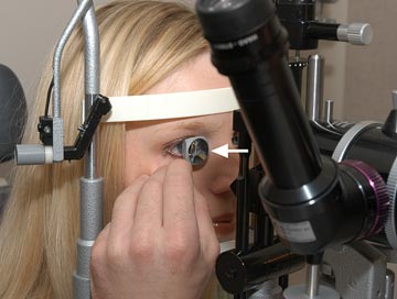 Ch 6 The glaucoma eye examination and diagnosis. A Patient's Guide to Glaucoma