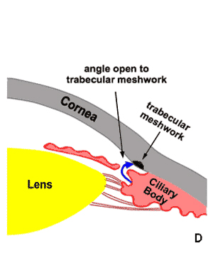 Ch 9. Glaucoma Emergency: Acute angle closure glaucoma. A Patient's ...