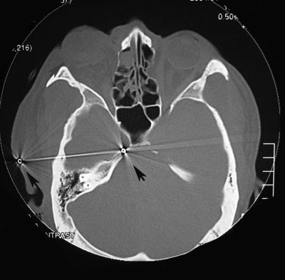 Ocular Trauma, assessment and management