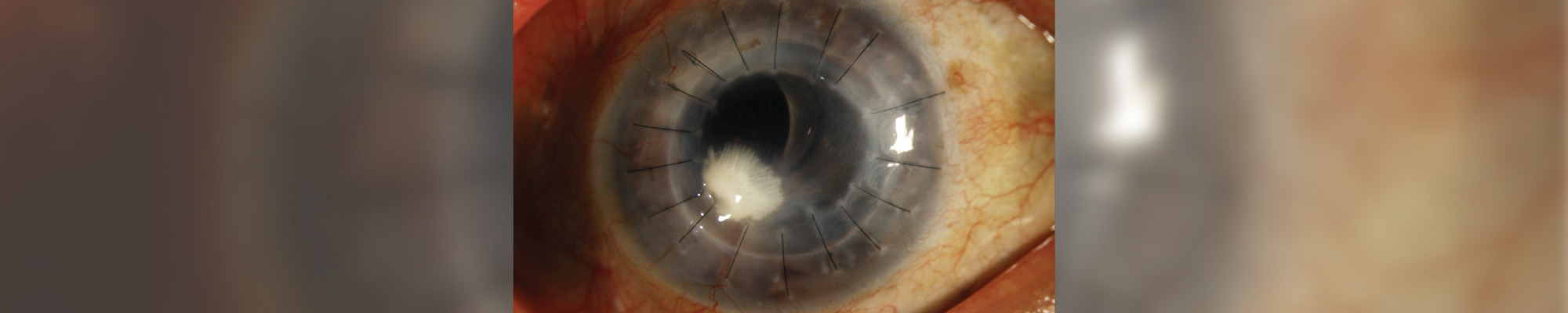 EyeRounds. Case reports, tutorials, videos, images from Univ of Iowa ...