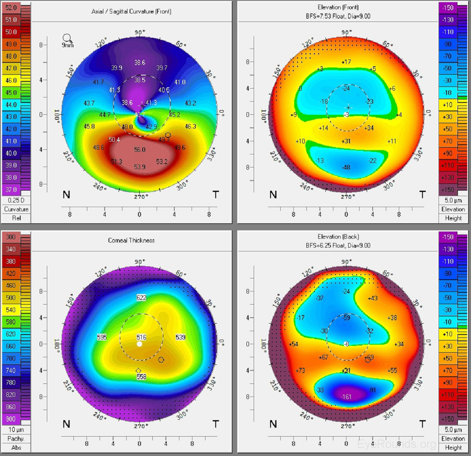 Corneal Imaging An Introduction