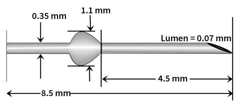 MIGS: Minimally Invasive Glaucoma Surgery